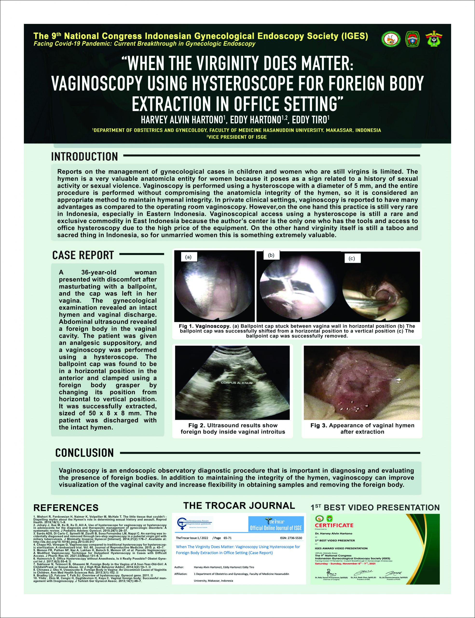 When The Virginity Does Matter : Vaginoscopy Using Hyteroscope fore ...